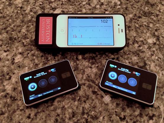 The iLet (Bionic Pancreas) – SUGAR HIGH SUGAR LOW – TYPE 1 D LIFE